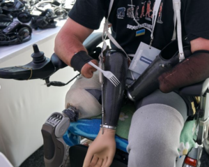 How Buffett's $800M rehab rebuild lives of Ukraine's war amputees